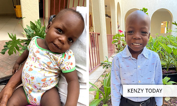 Kenzy... He Can Melt Your Heart with a Smile! - Love A Child